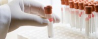 ExamOne – A Quest Diagnostics Company